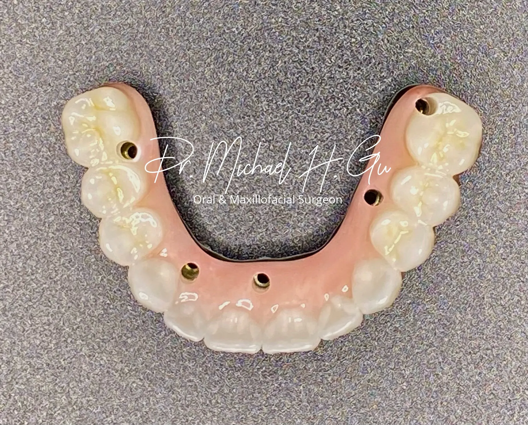 Smart Denture Conversion Quincy MA, South Shore Oral Surgery Associates